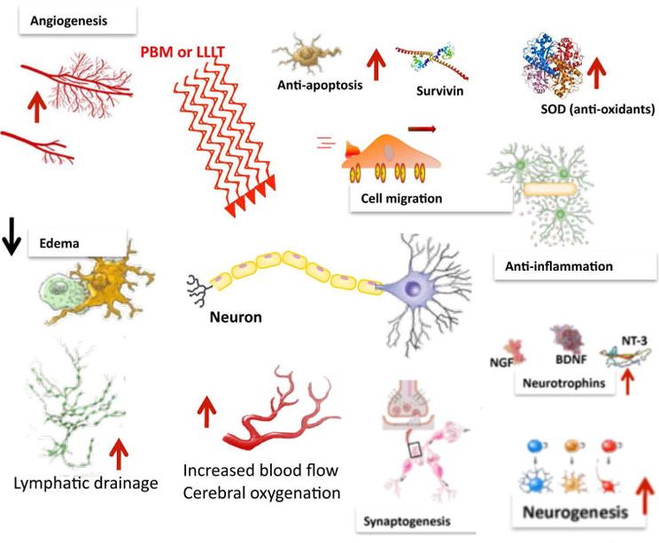 Photobiomodulation for Traumatic Brain Injury and Stroke – ThinkFast Cap